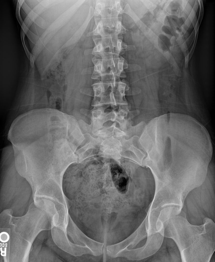 App-Chiro - Televere Systems