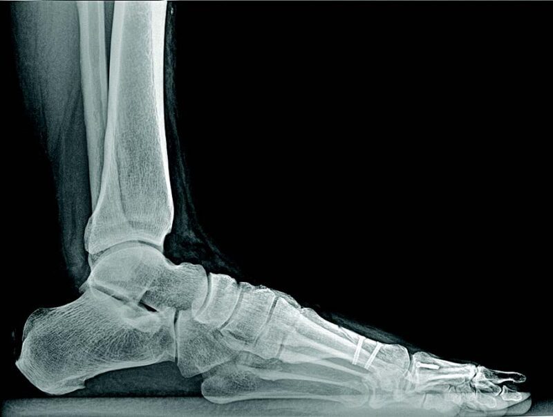 Tiger DRX Complete Gadox-POD - Televere Systems