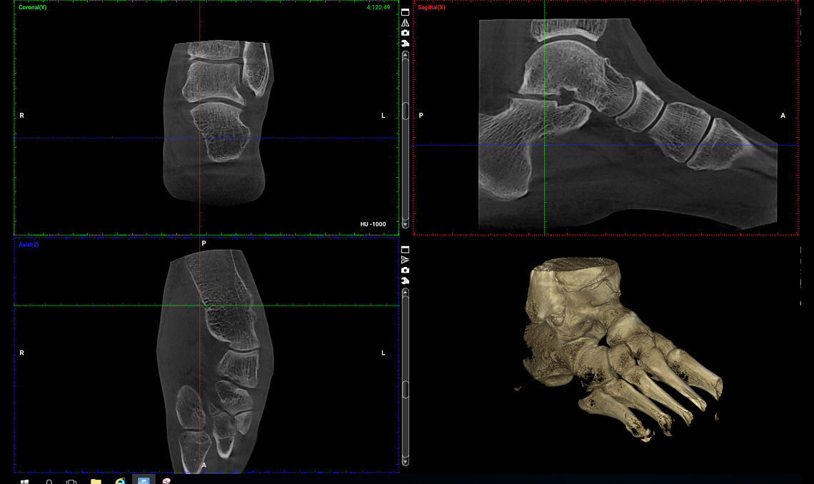 Planmed Verity - Ortho - Televere Systems