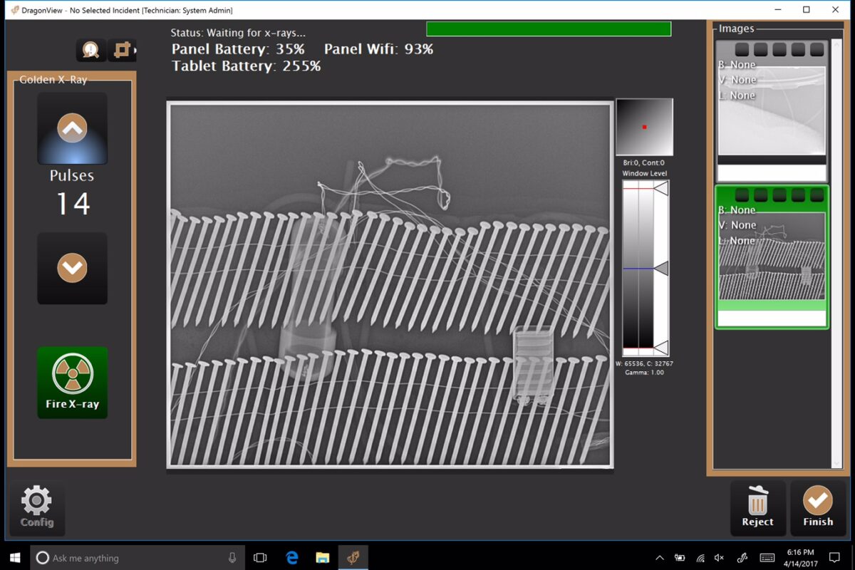 DragonView X-Ray System - Televere Systems
